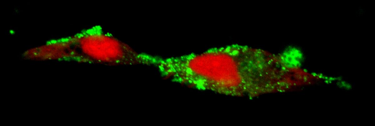 Helping the brain de-toxify could slow Alzheimer's - Sanford Burnham Prebys