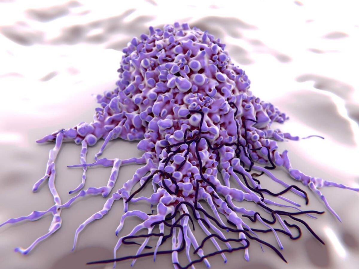 Immune scavenger cells: Good guys or bad guys? - Sanford Burnham Prebys