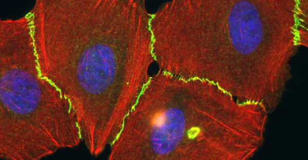Rainbow-seq: Combining Cell Lineage Tracing with Single-Cell RNA Sequencing in Preimplantation ...
